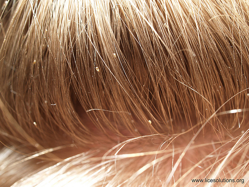 Three Stages of Growth for Lice
